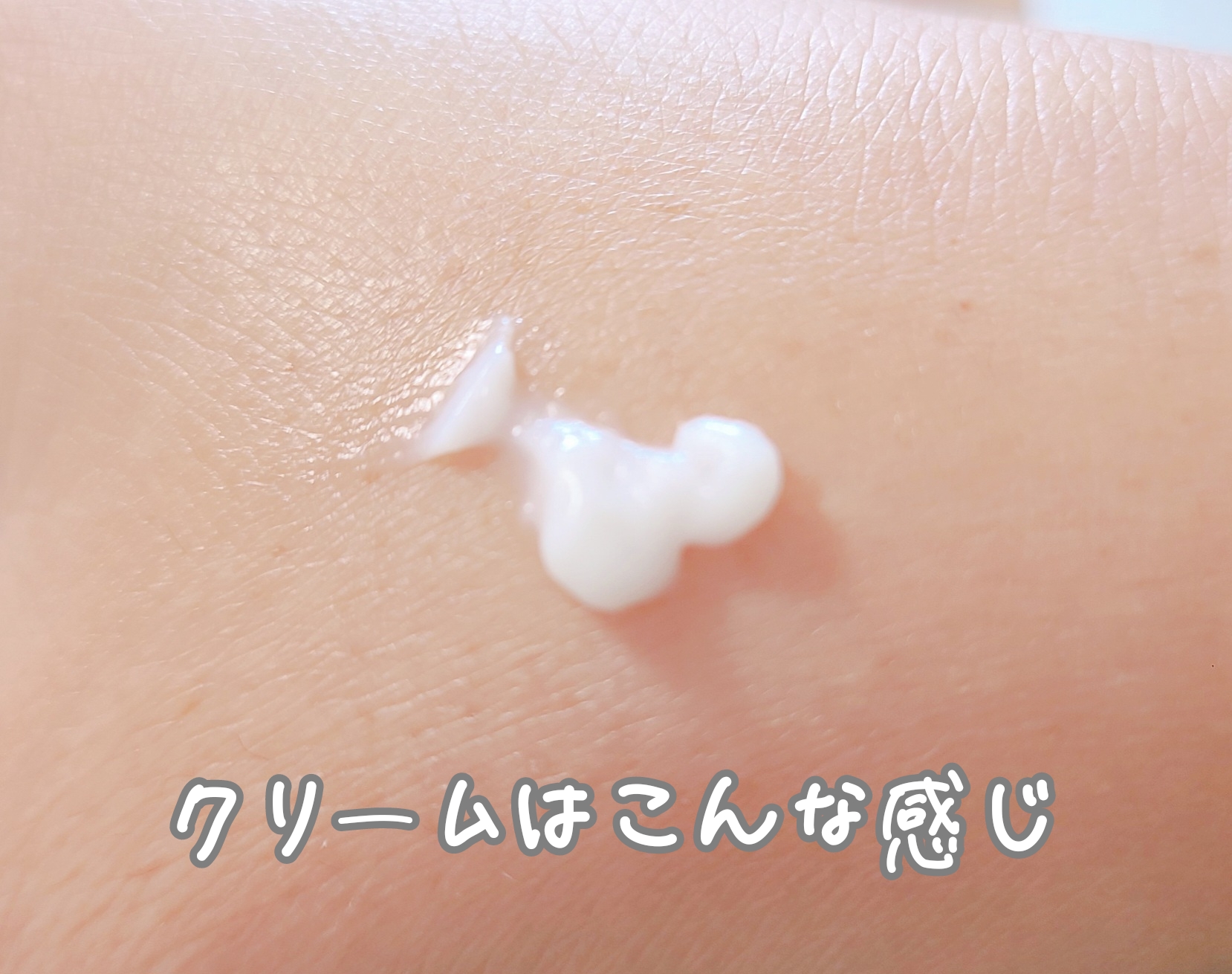 【SNSで話題】KISO 純ハイドロキノン2％配合クリームを使ってみた。通販で買えるプチプラハイドロキノンクリーム。 | おかんの知りたいこと